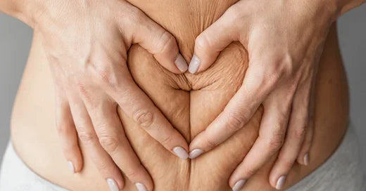 Get rid of stretch marks naturally – Satliva Nature Nurtures
